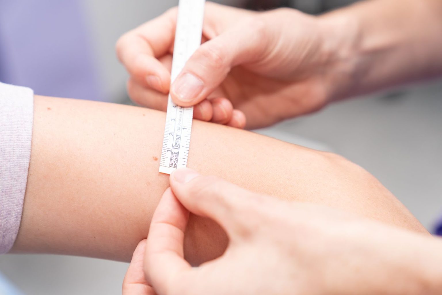 Surgical Skin Cancer Management Mailtand - Elixir @ Hunter